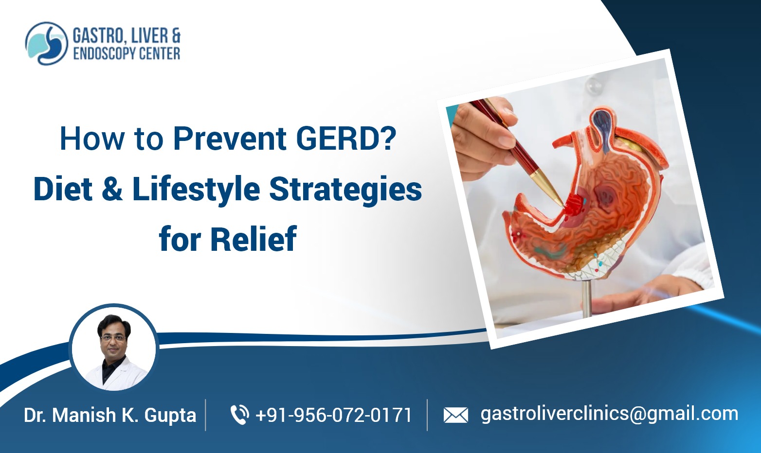 How to Prevent GERD: Diet & Lifestyle Strategies for Relief