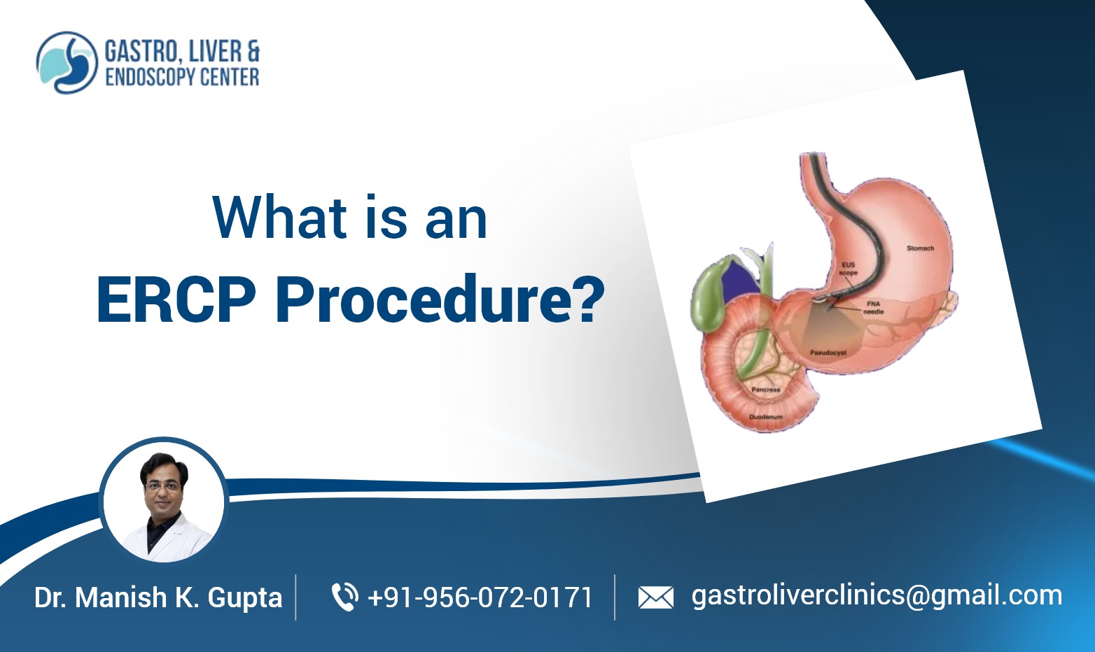 What is an ERCP Procedure ? Dr. Manish K. Gupta