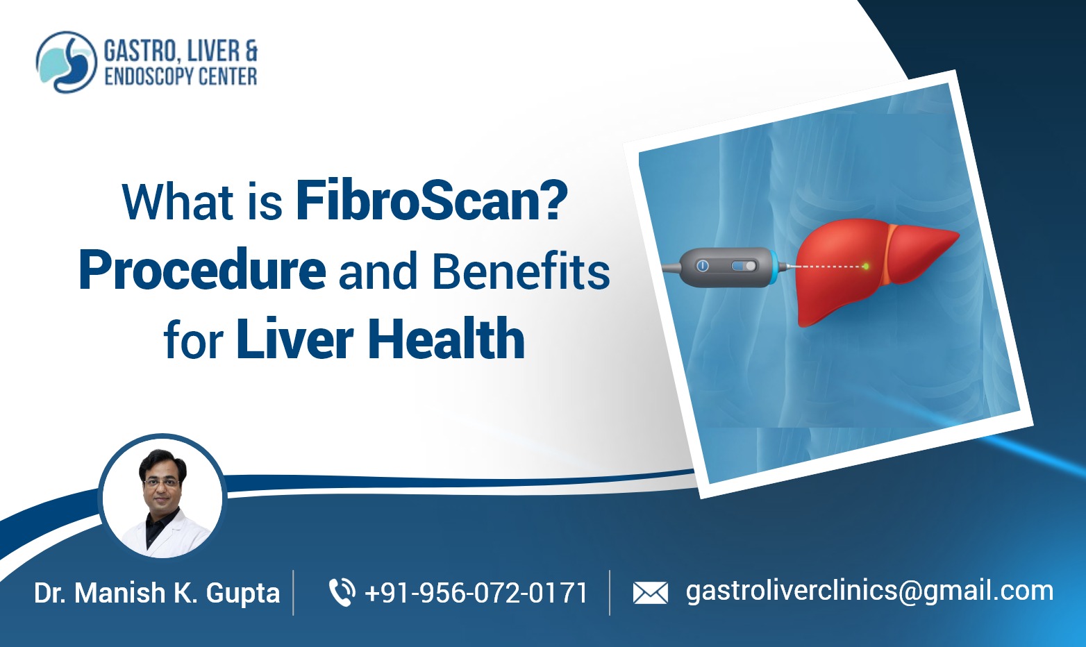 what is a fibroscan ? Procedure and Benefits for Liver Health
